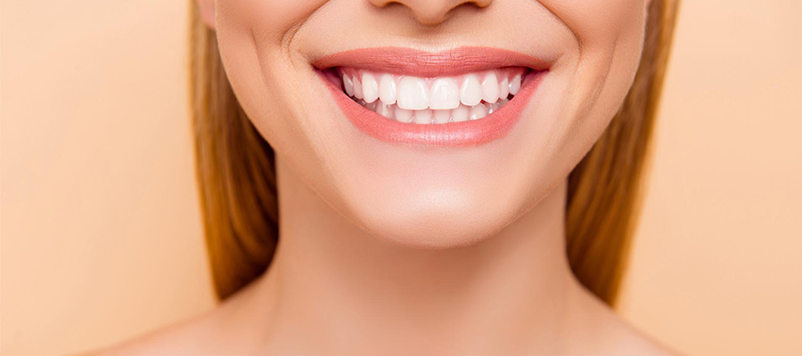 Hollywood Smile in Turkey - Implant Treatment in Turkey - Implant ...